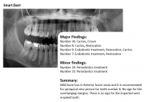 Features – Smart Dent