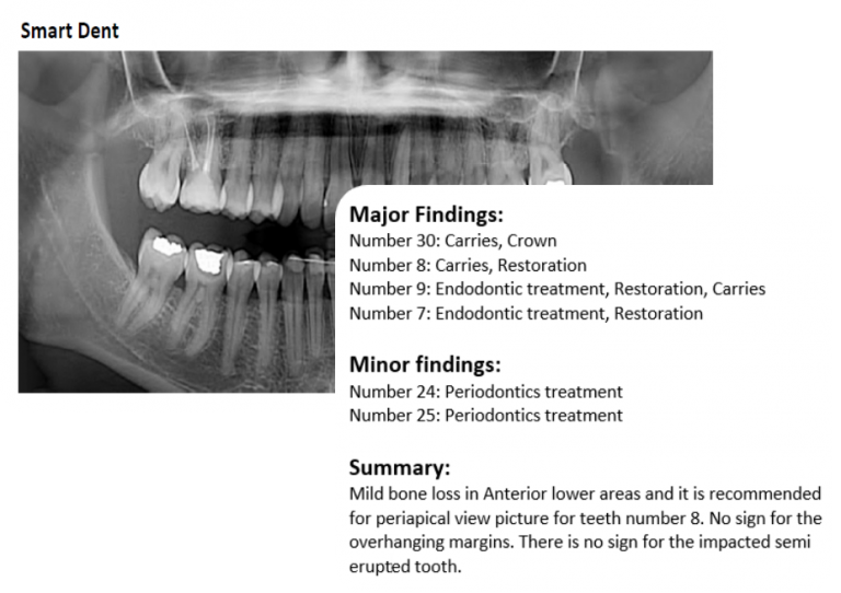 Features – Smart Dent
