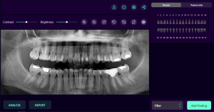 Smart Dent – Smart Dent
